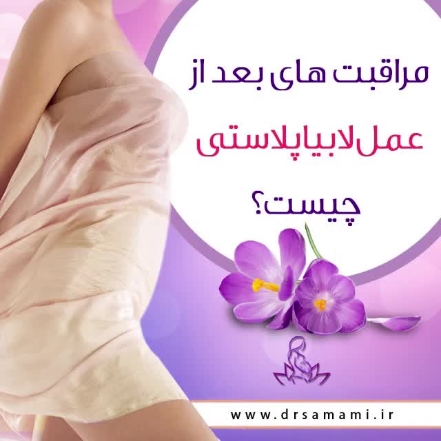 دلایل لابیاپلاستی بعد از زایمان تماشا